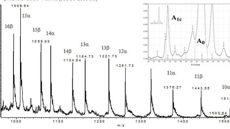 Heterogeneity of Glycated Haemoglobin as Revealed by Chromatography ...