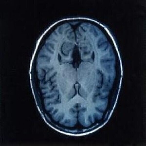 Scientists uncover role of alpha 2 delta in relaying thoughts, feelings ...